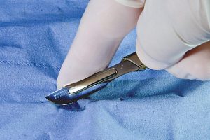 Acne Treatment St Louis | Arch Dermatology Institute